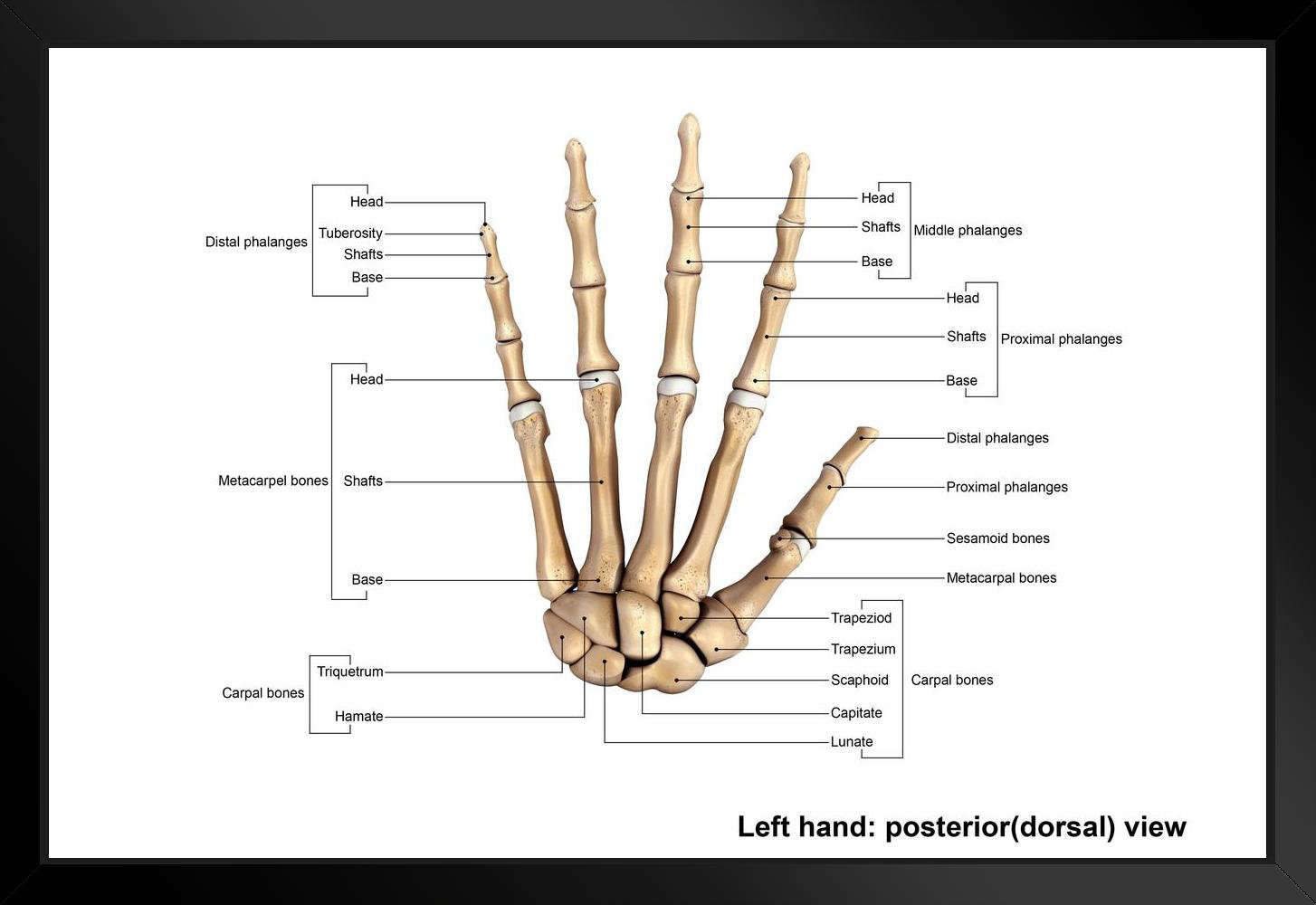Trinx Human Left Hand Posterior Dorsal View Bones Anatomy Chart Medical ...